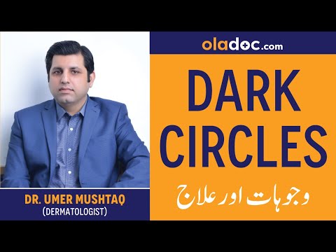The Causes of Dark Circles Ki Wujuhaat In Urdu/Hindi | Dark Circles Treatment | Dark Eye Circles
