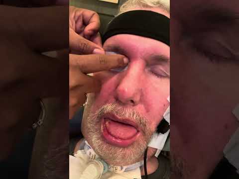 Taping an eye shut - YouTube