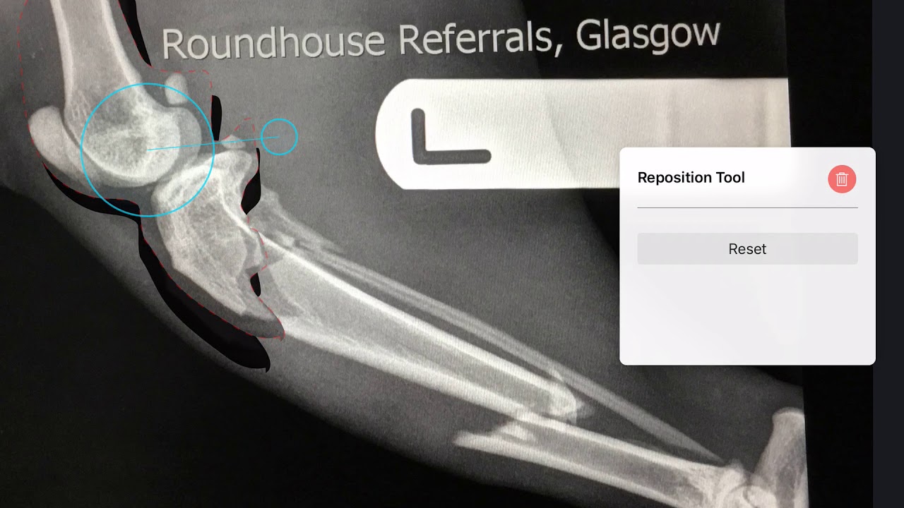 Segmental Fracture Cat Tibia - Repaired with LCP - YouTube