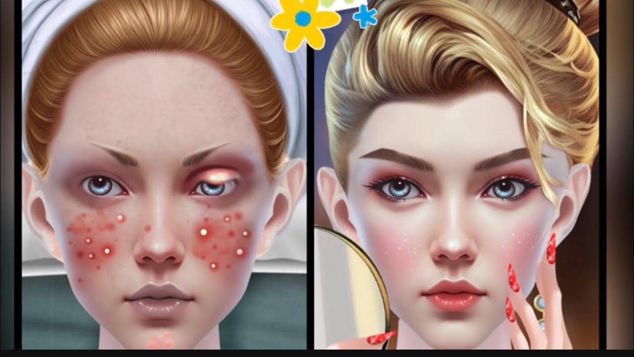Asmr Homeless Girl Transformation Makeup Animation 메이크업애니메이션 Pimple