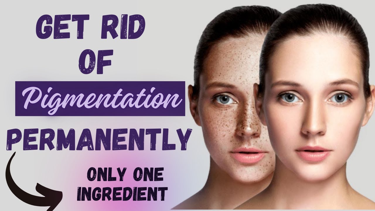 Get Rid Of Pigmentation Permanently 🪄 With Only One Ingredient 🌺 - YouTube