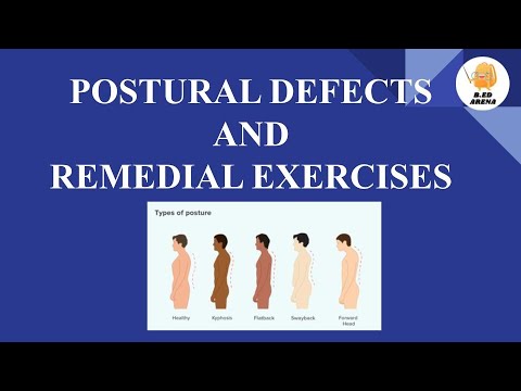Postural Defects | Remedial Exercises | Physical education notes | B.ed ...