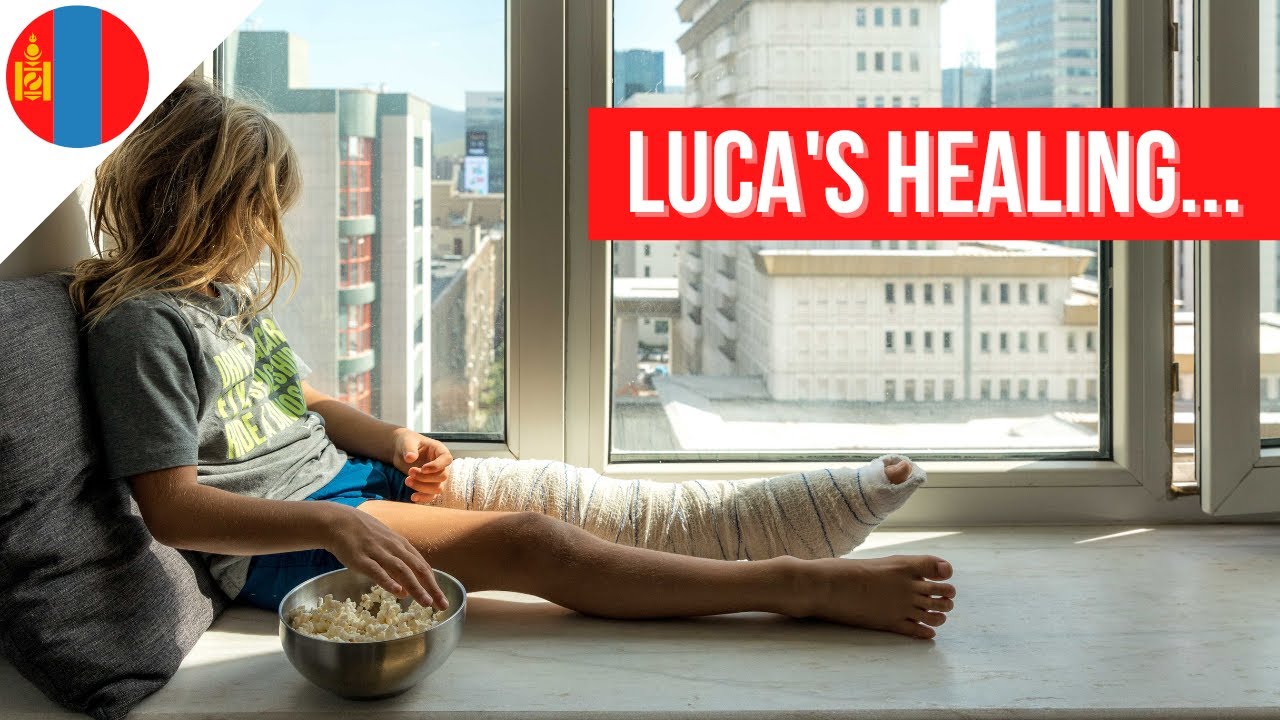 Luca's broken leg healing during our time in Mongolia - YouTube