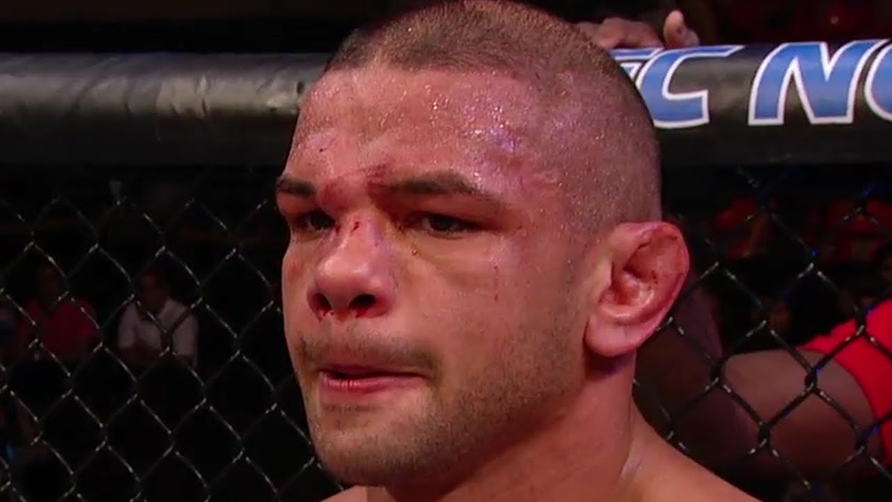 Ufc Broken Nose