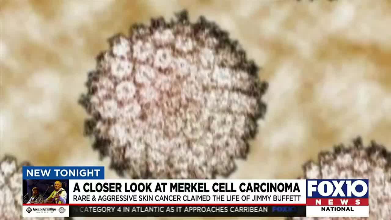 Closer look at Merkel Cell Carcinoma with USA Mitchell Cancer Institute ...