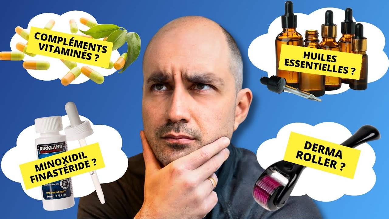 Calvitie : Ce que tu dois savoir avant de prendre un traitement anti ...