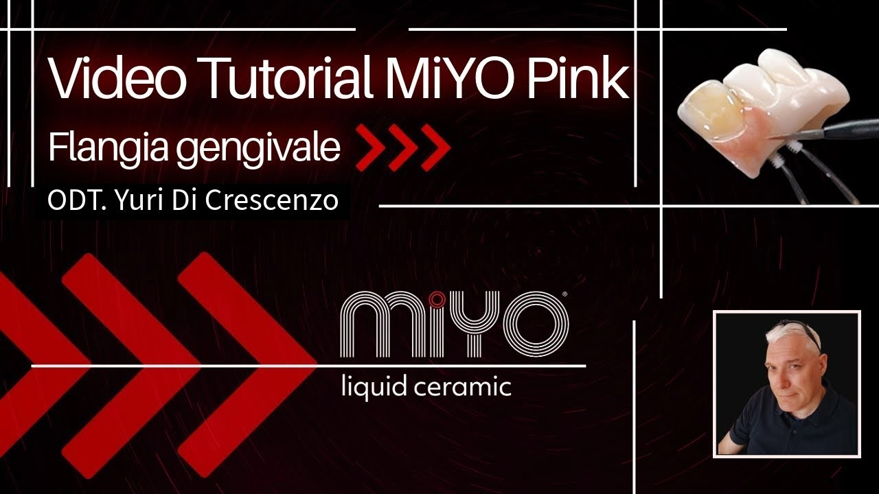 Video Tutorial MiYO Pink - Microstratificazione flangia gengivale - YouTube