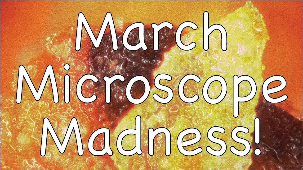 March Microscope Madness Week 2 2015 YouTube march-microscope-madness-week-2-2015-youtube
