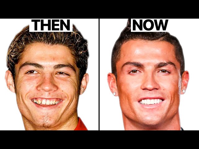 Cristiano Ronaldo 2003 Teeth