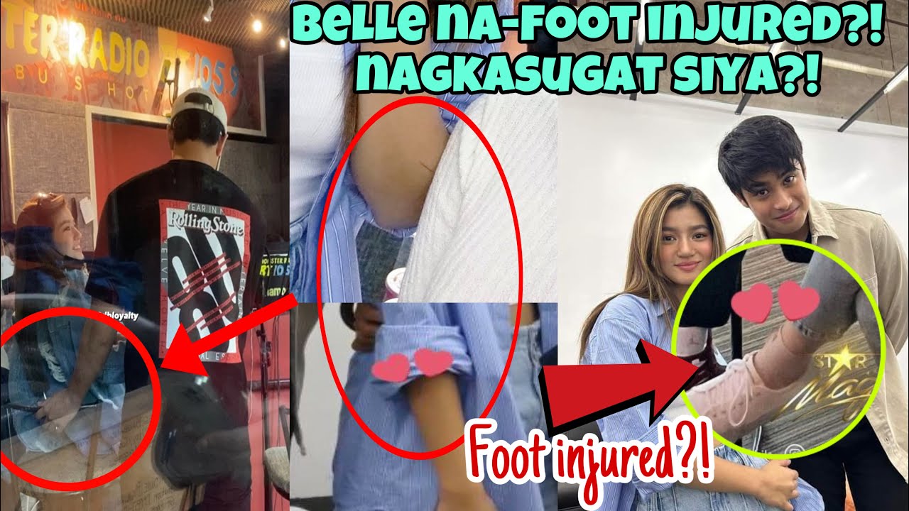 BELLE nagka-foot injured?! may mga sugat rin sa kamay?! | kaya naman si ...