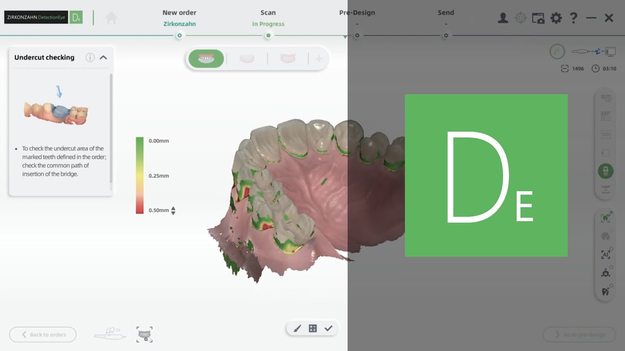 Software functions during the scanning process | Zirkonzahn ...