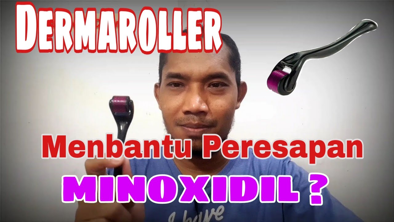 Cara Penggunaan Dermaroller Plus Minoxidil Untuk Menumbuhkan Rambut