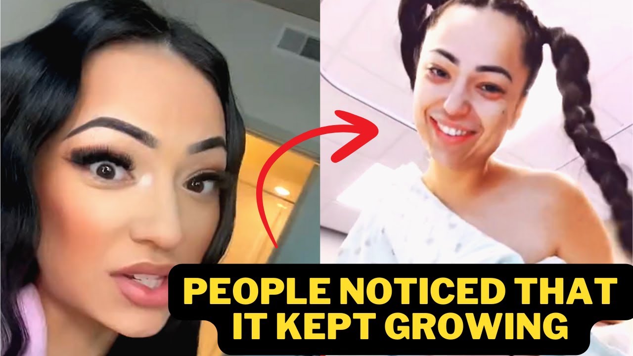 Another Ig Model Nearly Loses Her Life Because Of BBL. - YouTube