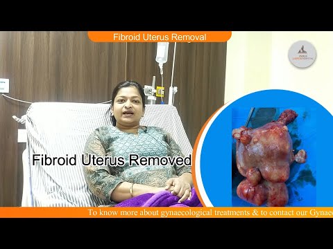 Uterine Fibroids Removed | Hysterectomy done by Dr. Mamta Mehta