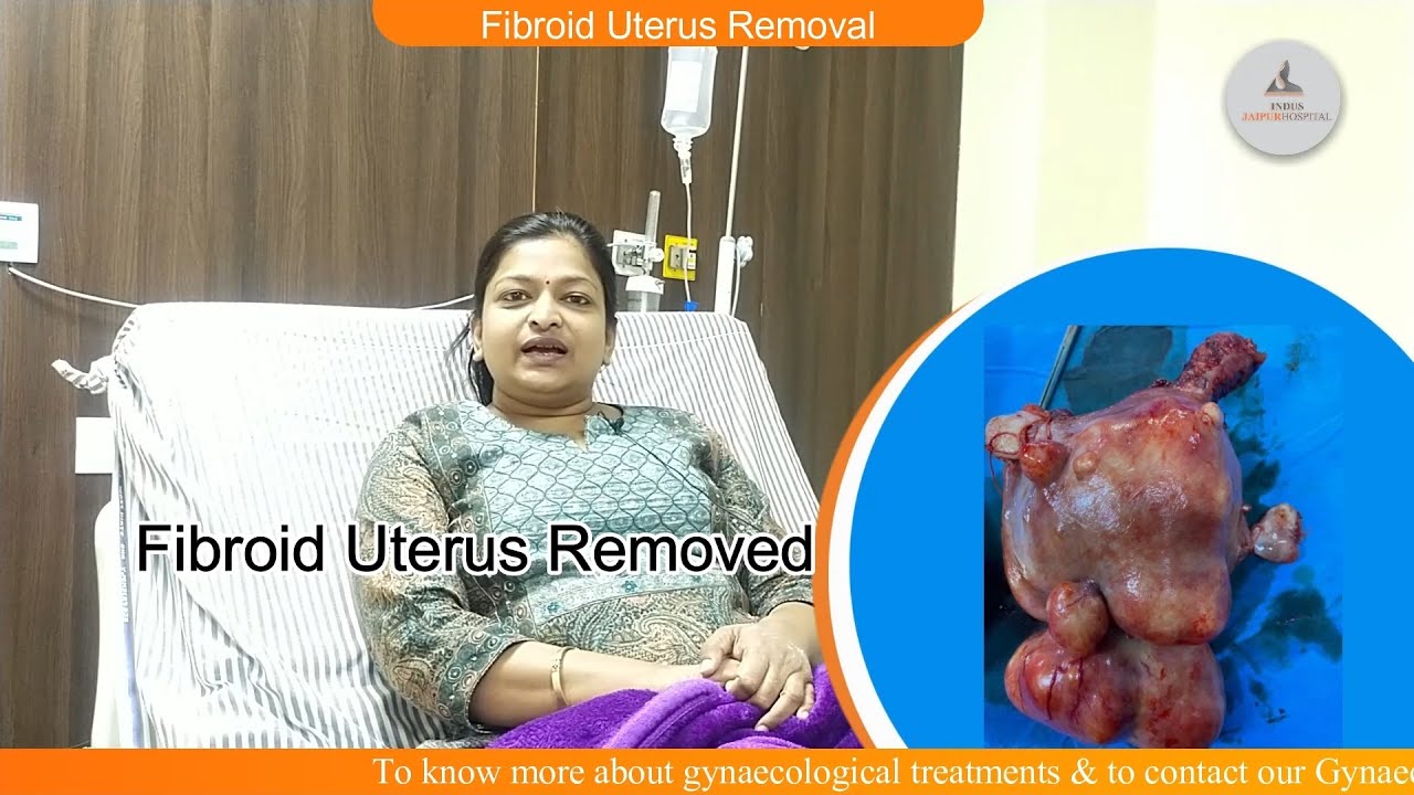 Uterine Fibroids Removed Hysterectomy Done By Dr Mamta Mehta Youtube
