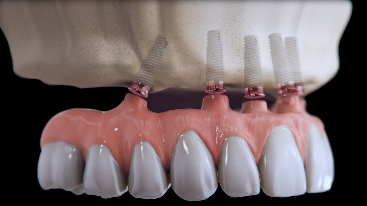 matrix® ProFlex - YouTube