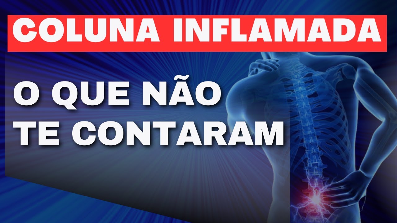 Coluna Inflamada - O que não te contaram - YouTube