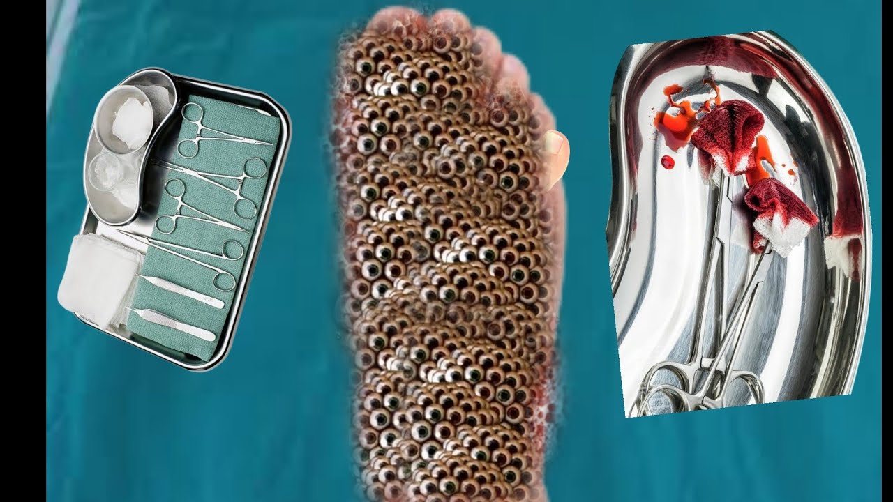 Leg Treatment Properly। Asmr Leg Animation।Deep Cleaning System - YouTube