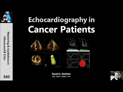 Echocardiography in Cancer Patients - YouTube