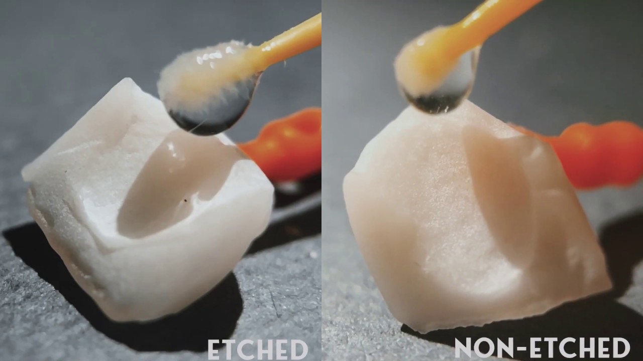 Lithium Disilicate (EMAX) Etched vs Non-Etched - YouTube