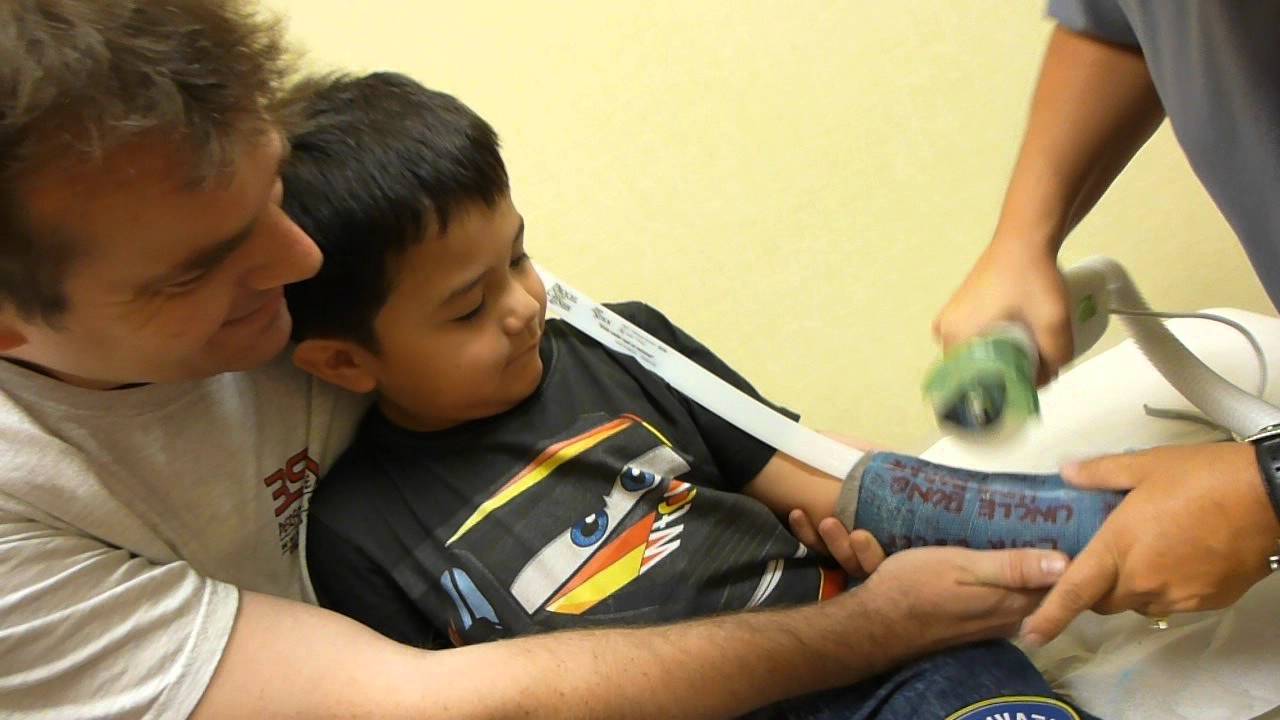 Calvin getting his cast cut off 2012 - YouTube