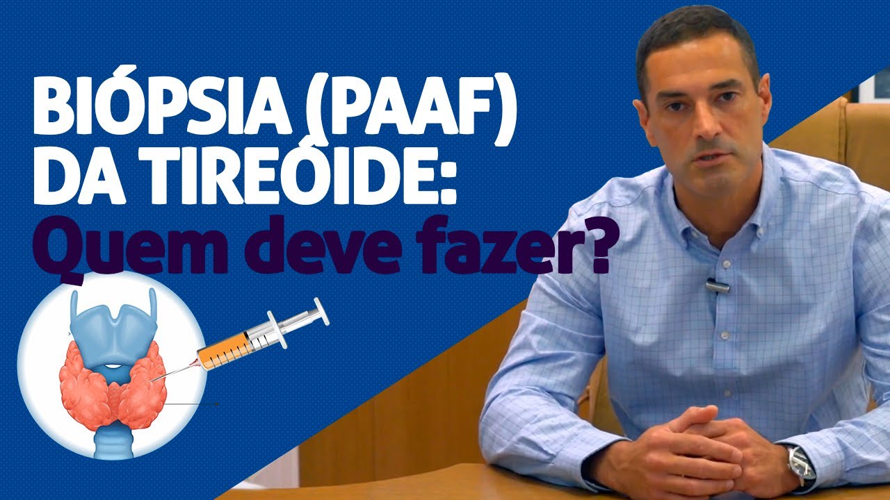 QUAIS NÓDULOS DEVEM FAZER A PAAF (BIÓPSIA) DA TIREÓIDE? - YouTube