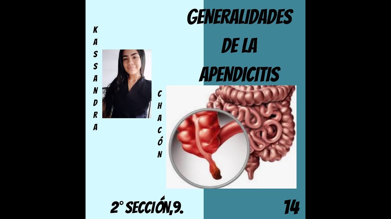 GENERALIDADES DE LA APENDICITIS (4) - YouTube