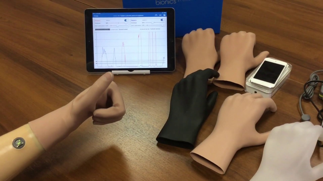 Touch Bionics i-limb ultra - YouTube