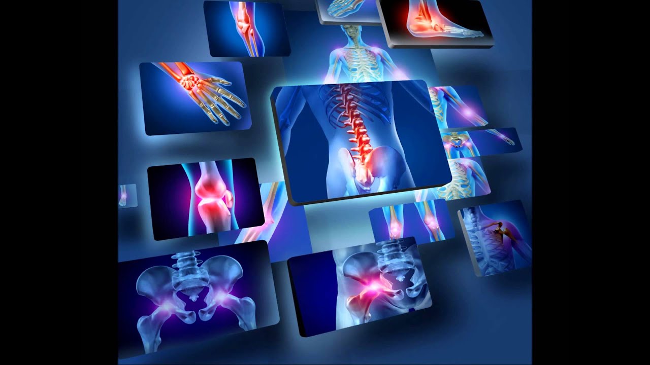 Osteoarthritis in Peoria IL | Tuttle Chiropractic | Dr. Justin Tuttle ...