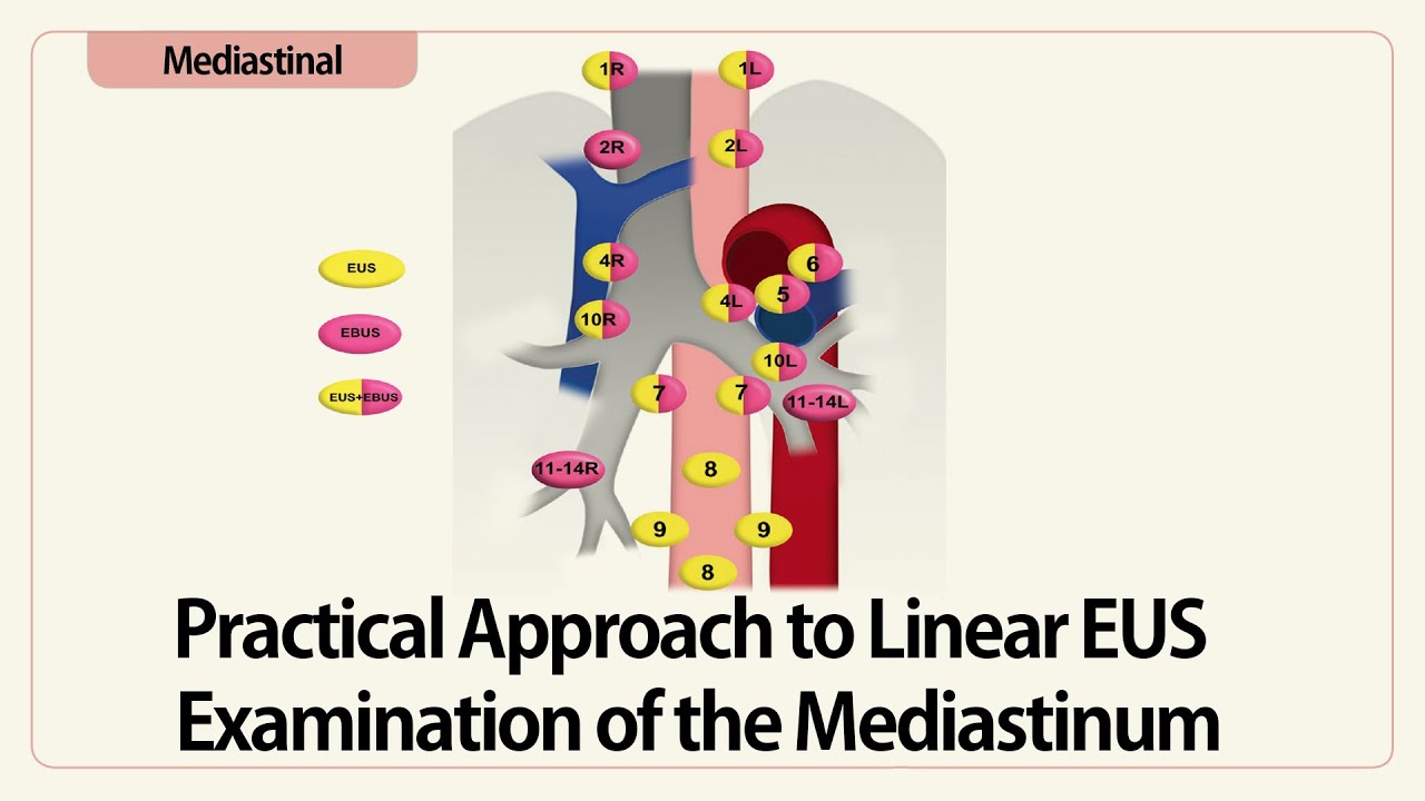 Linear EUS: Practical Approach to Linear EUS Examination of the ...