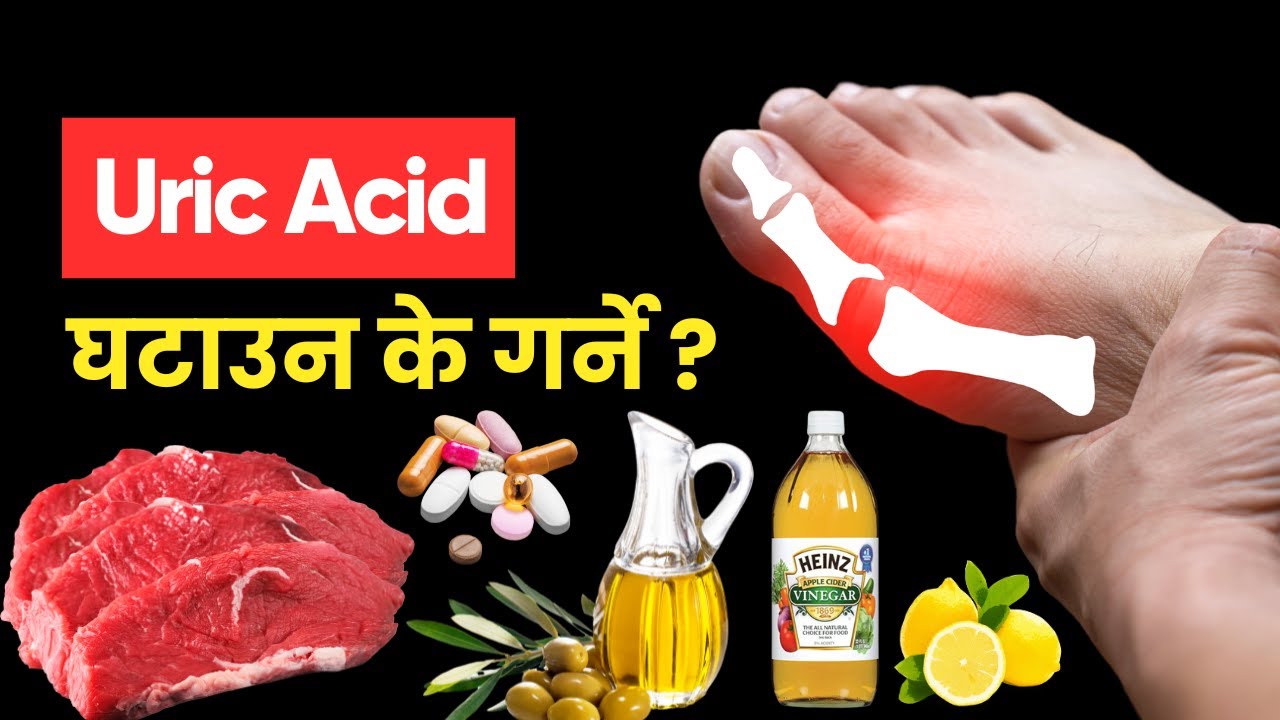 How to Control Uric Acid ? 🩺💓 Don’t miss out on tips for a healthier ...
