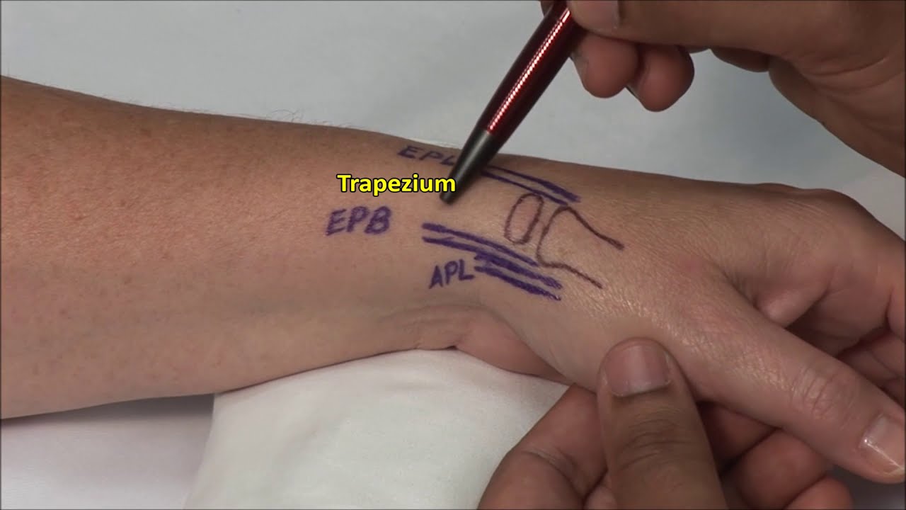 Carpal Metacarpal Joint Injection