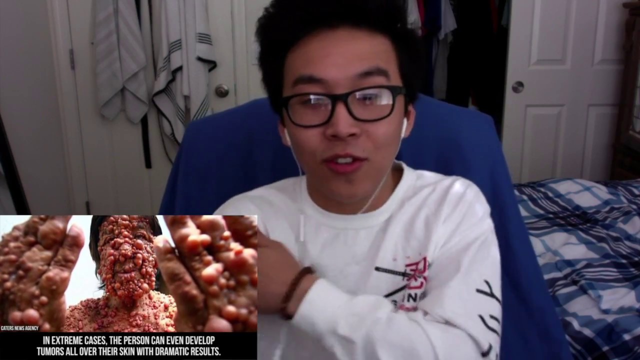 Top 10 scariest disease in the world reaction video!!! - YouTube