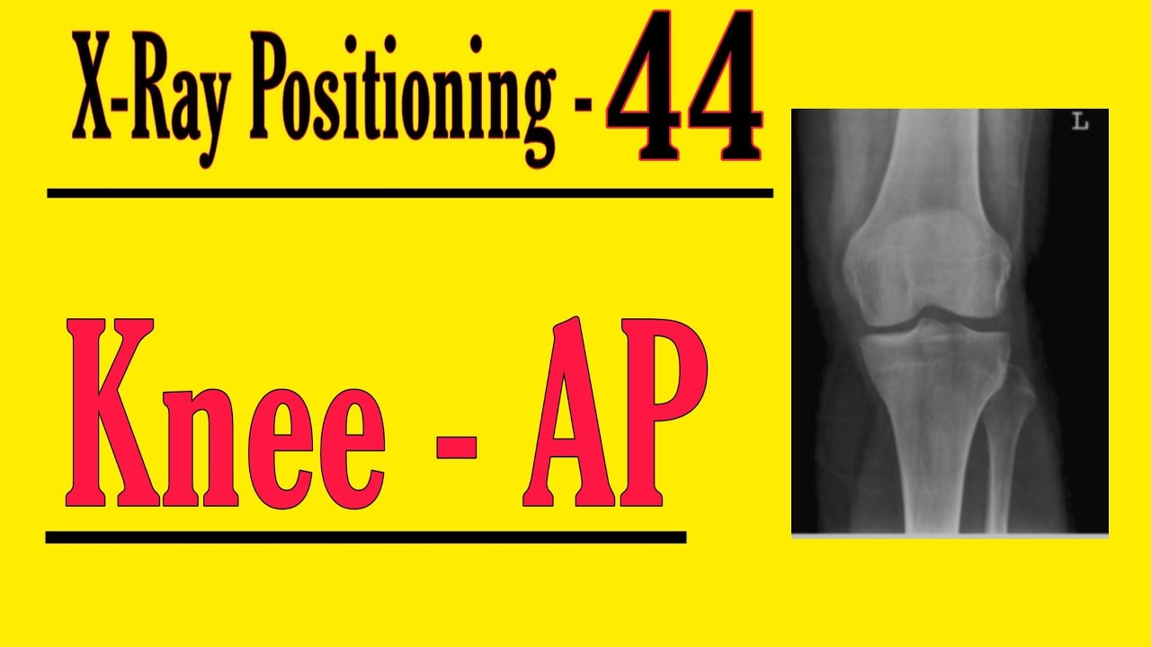 KNEE AP POSITIONING HINDI | X RAY POSITIONING FOR RADIOGRAPHERS ...
