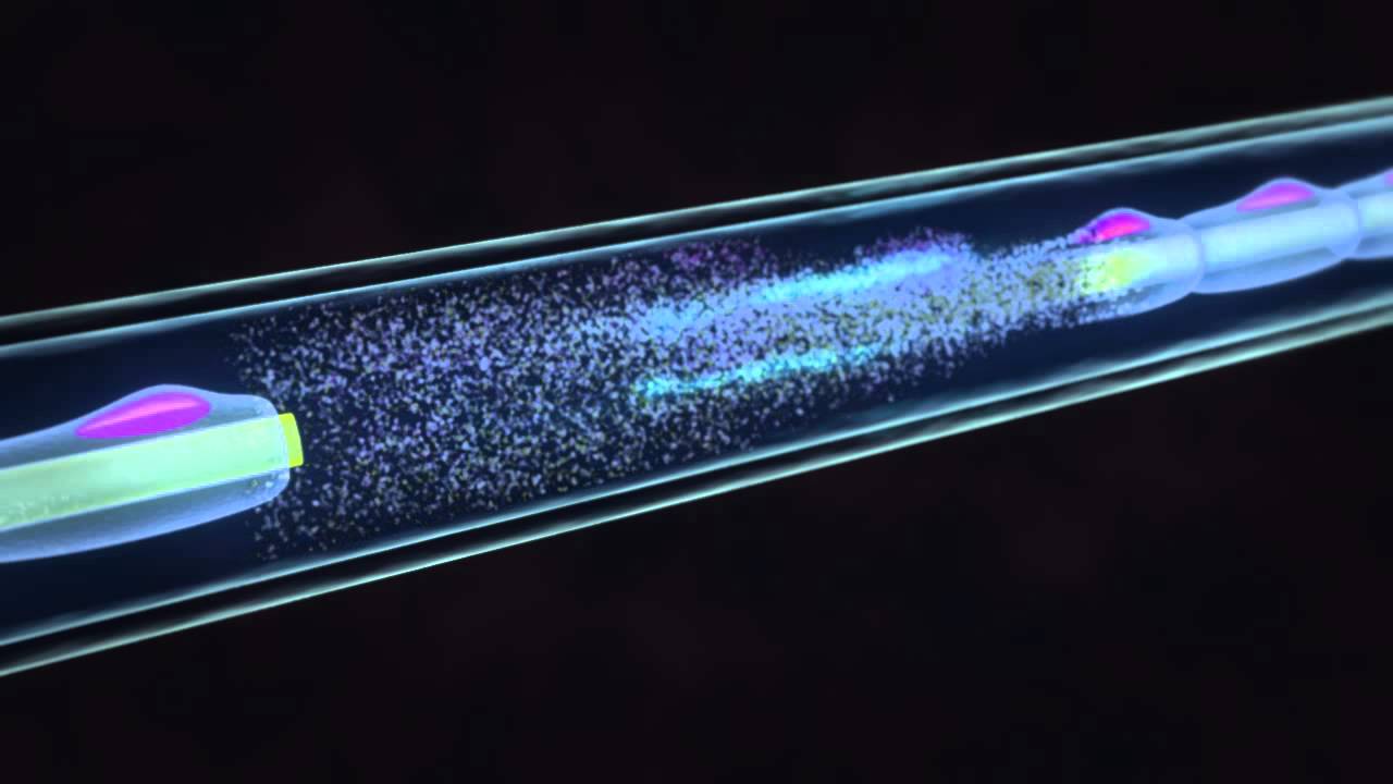 How iovera Works for Knee Pain - Dr. Halland Chen, MD - YouTube