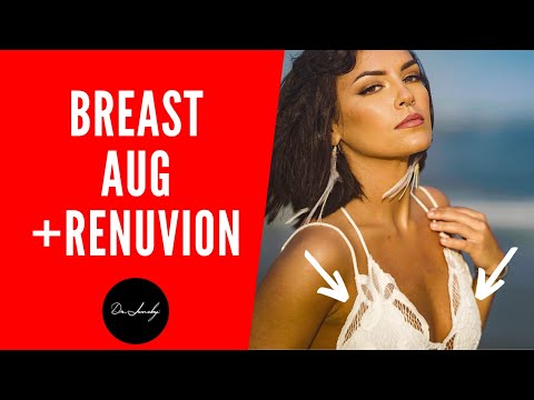 Breast Aug + Liposuction + Renuvion |Dr Jeneby Renuvion | Top plastic surgeon San Antonio Austin