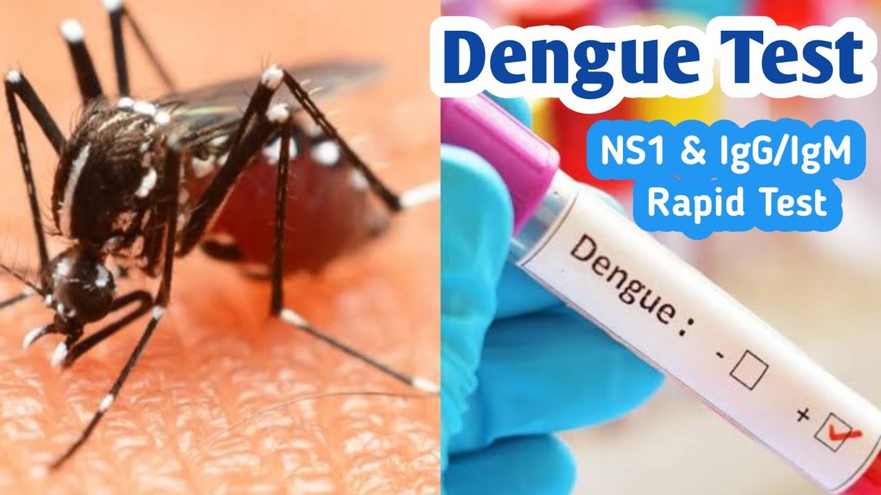 Dengue Test | কিভাবে ডেঙ্গু পরীক্ষা করা হয় | NS1 and IgG/IgM Rapid ...
