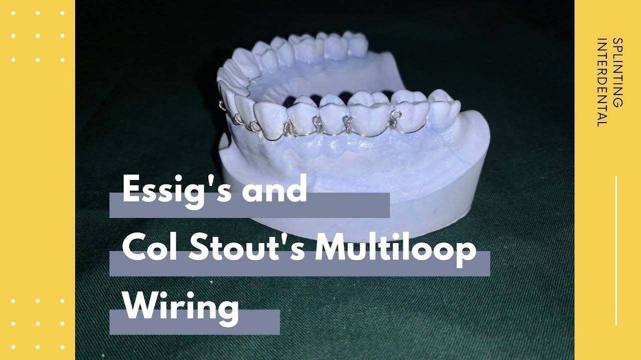 Essig's dan Col Stout's Multiloop Wiring - YouTube