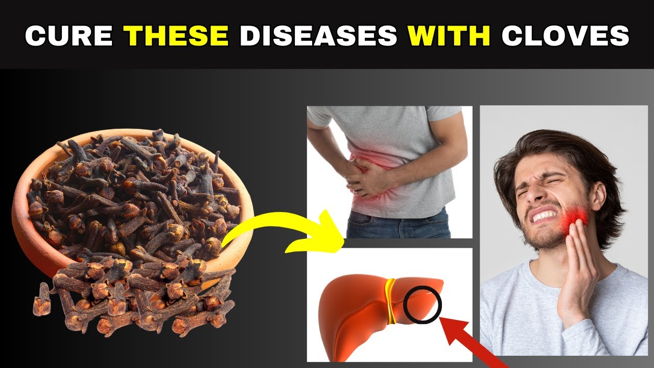 Top 9 Conditions You Can Treat With Cloves! - YouTube
