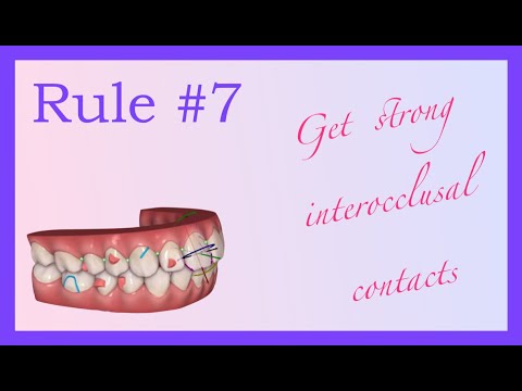 Get Strong Interocclusal Contacts - Invisalign Mini Course 8 of 8 - YouTube