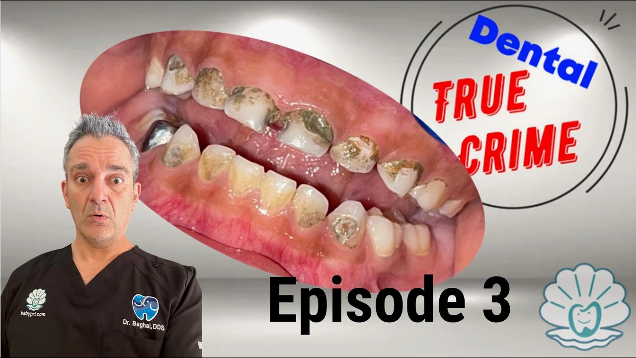 Dental True Crime, Part 3 of 3 - YouTube