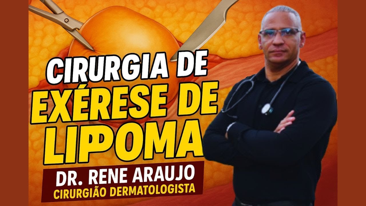 Exérese de Lipoma - Dr. Rene Araujo - Cirurgião Dermatologista - YouTube