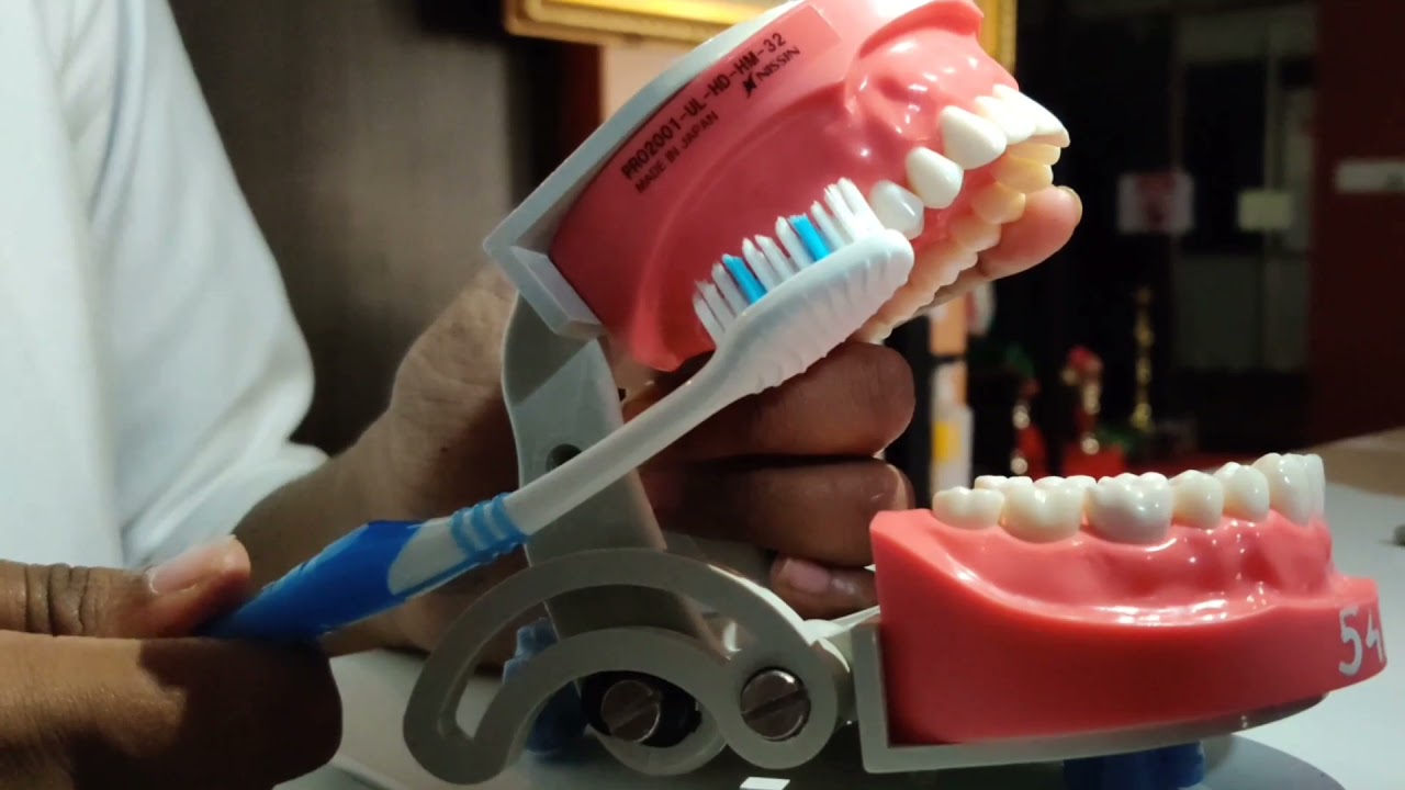 Dr Athira, CRI teaches Brushing technique in case of gingival recession ...