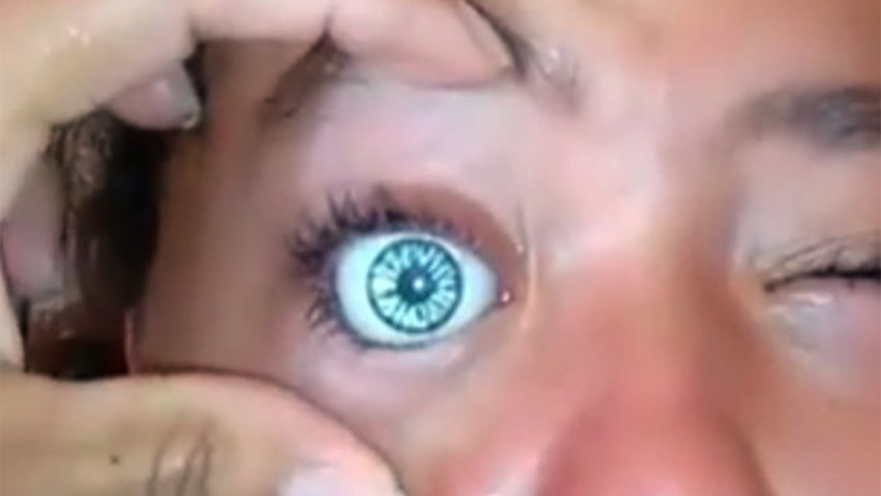 Glass Eye Socket