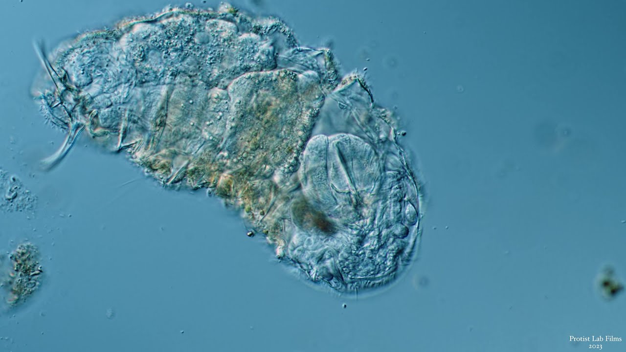 Rotifer Notommatidae: 𝙏𝙖𝙥𝙝𝙧𝙤𝙘𝙖𝙢𝙥𝙖 𝙨𝙚𝙡𝙚𝙣𝙪𝙧𝙖 Gosse, 1851 - YouTube