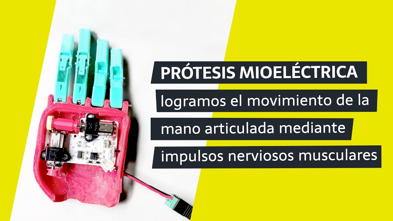 Prótesis mioeléctrica de mano impresa en 3D - YouTube