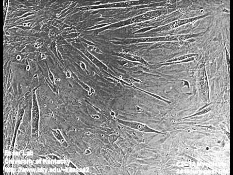 C2C12 cells differentiating over 16 hours. - YouTube