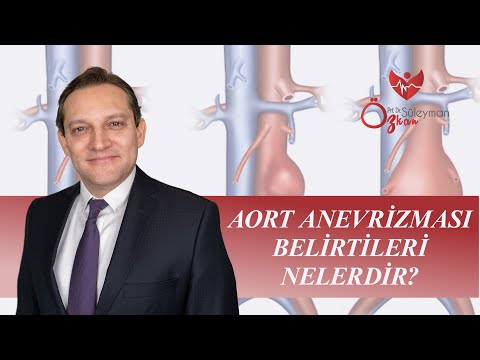 Aort Anevrizması Belirtileri Nelerdir?