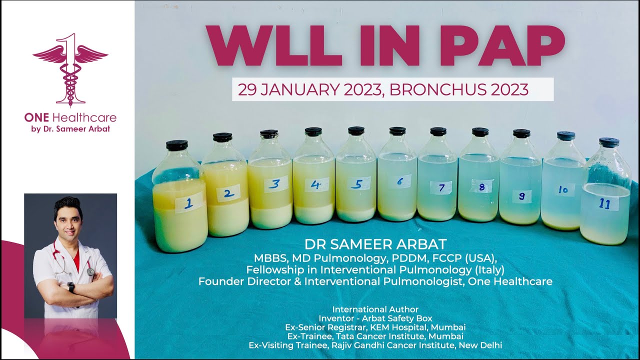 Whole Lung Lavage for Primary Alveolar Proteinosis -Dr Sameer Arbat at ...
