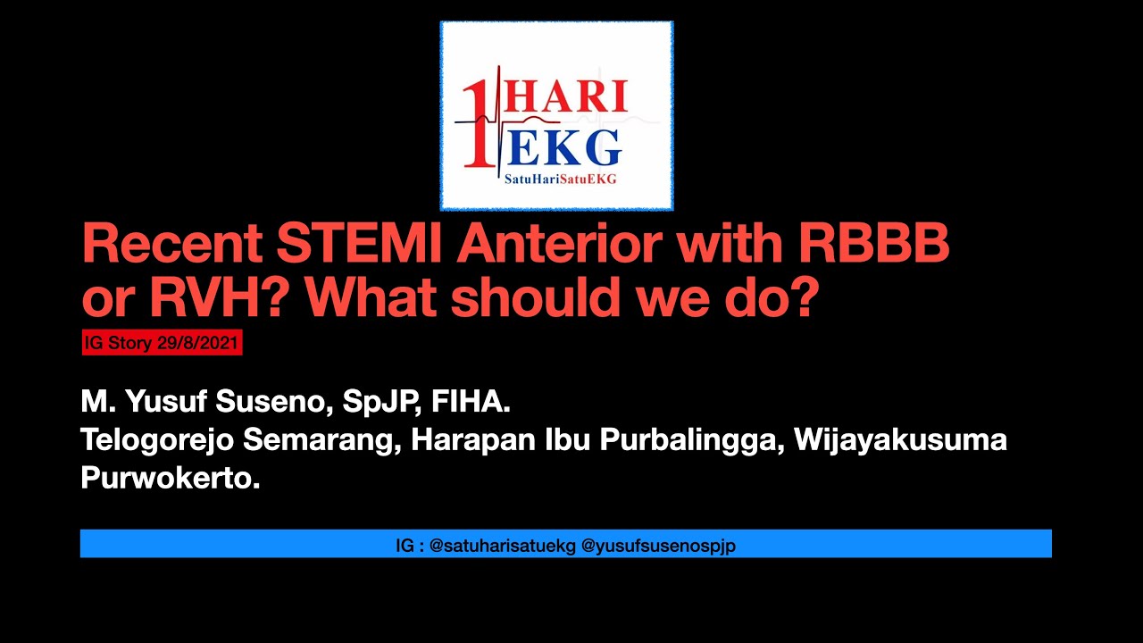 Bagaimana Mendiagnosa STEMI ANTERIOR Plus RBBB? Bagaimana Membedakan ...